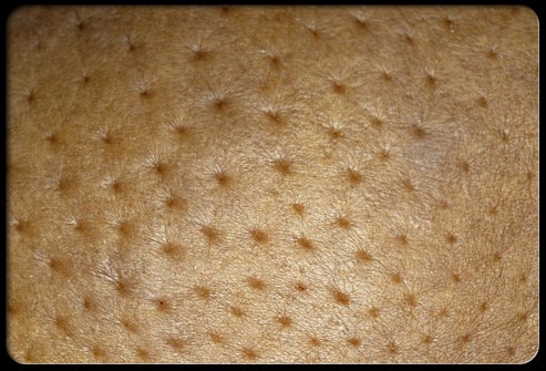 Top 10 Warning Signs of Breast Cancer - Kanigas